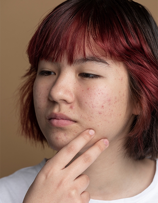 UÇUK - Uzm. Dr. Pınar Bozkurt - Dermatoloji Uzmanı - Adana Botoks ...